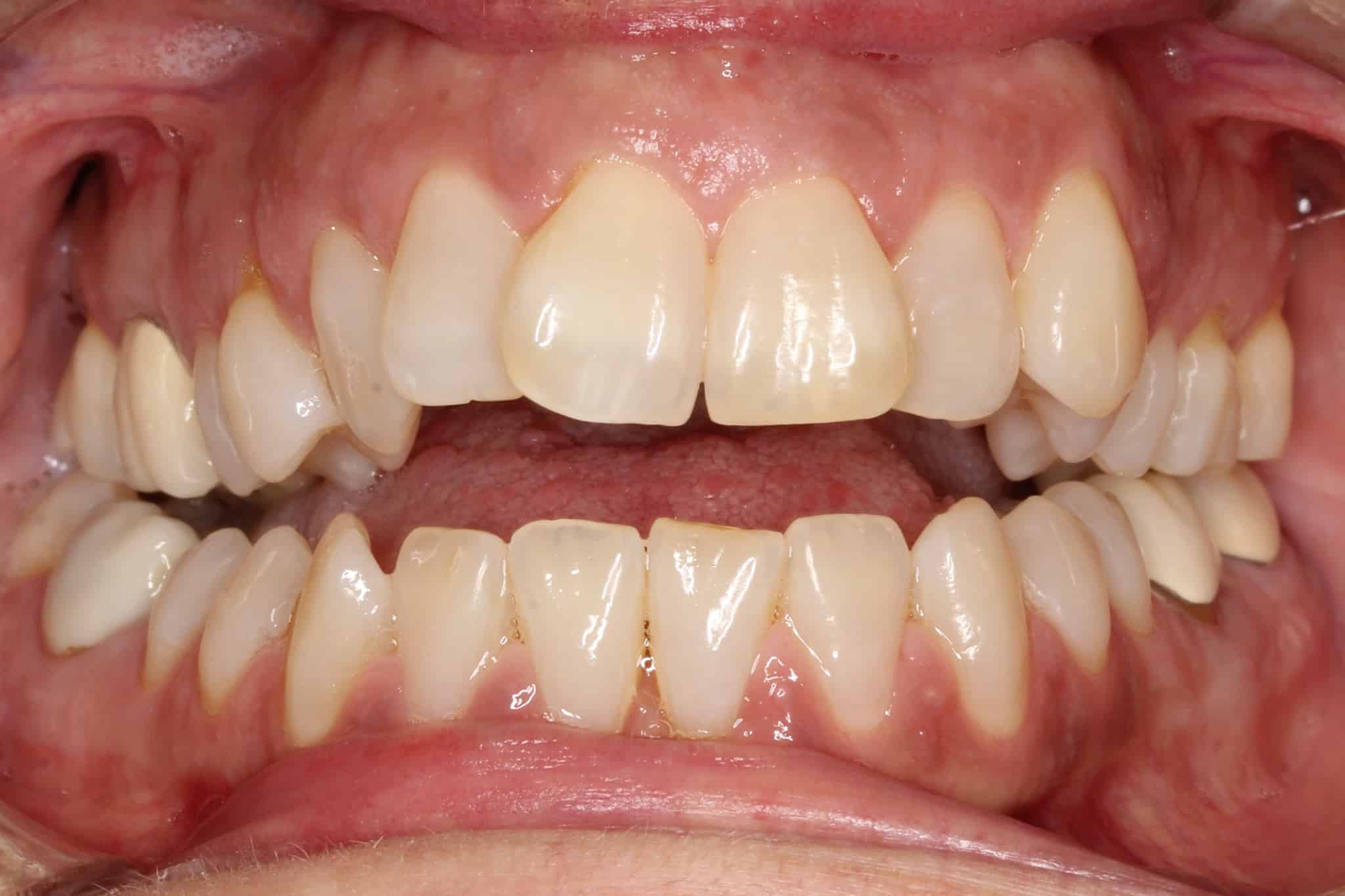 Common Orthodontic Problems Chelmsford MA